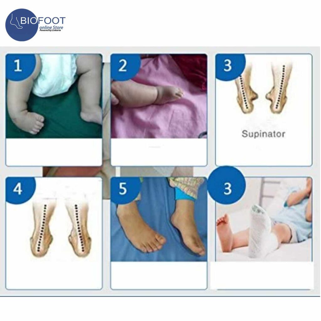 Buy Pediatric Night AFO Drop Foot Splint for Kids (16cm) Online Dubai ...